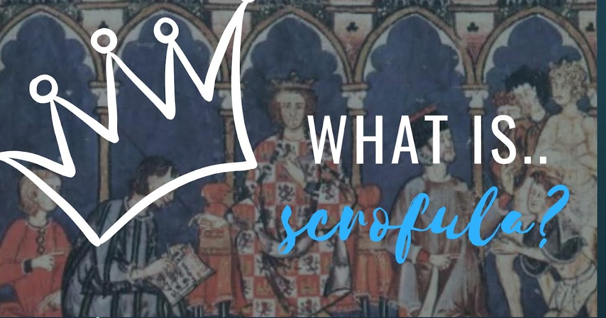 DIVULGACIÓN CIENTÍFICA UG: What is scrofula?