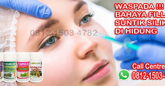 Cara Mengatasi Bengkak Akibat Efek Filler Suntik Silikon Di Hidung ...
