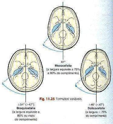Sintonize na Radiologia: Seios da Face e Cranio