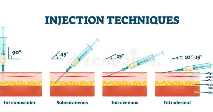 TYPES OF INJECTION