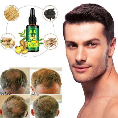 Ginger Hair Oil For Men: Ginger Hair Growth for Men
