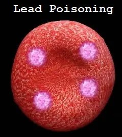 Lead Poisoning