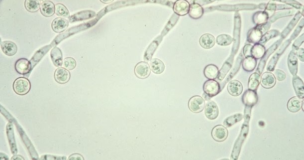 Kandida , İçimizdeki Sinsi Düşman : Kandida Mantarı