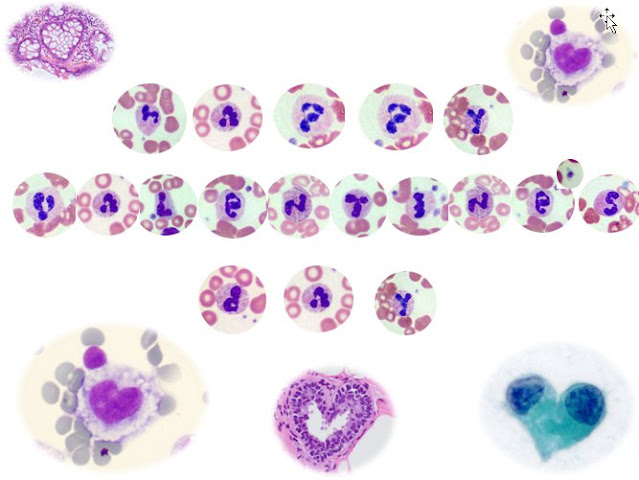 TYWKIWDBI ("Tai-Wiki-Widbee"): A cytology Valentine's Day greeting