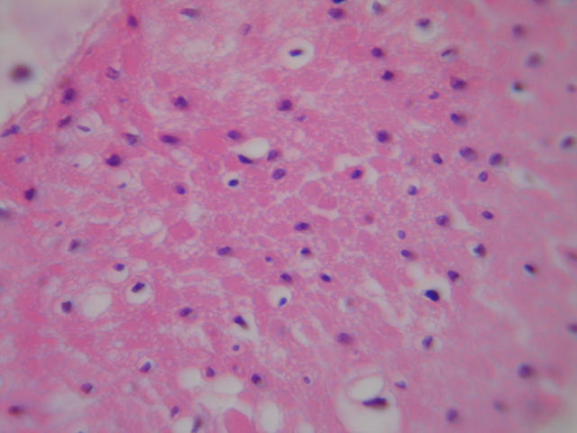 Histología en Imágenes : TEJIDO MUSCULAR LISO
