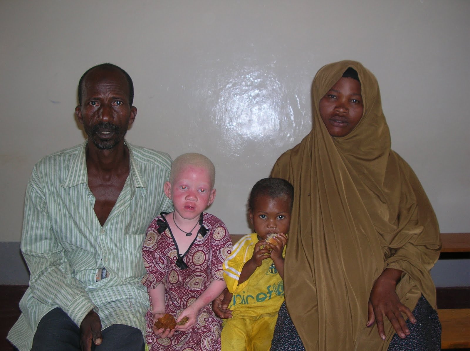A somali Albino in Muqdishu | Somali Spot | Forum, News, Videos