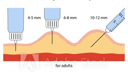 Diabetes : Lets learn how to inject insulin