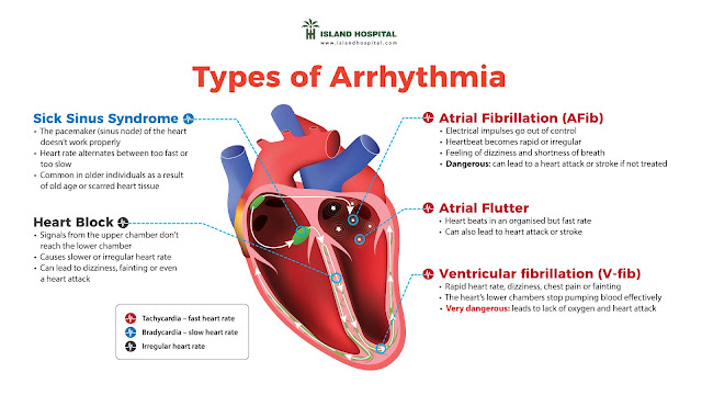 National Cancer Society of Malaysia, Penang Branch: Types Of Arrhythmia