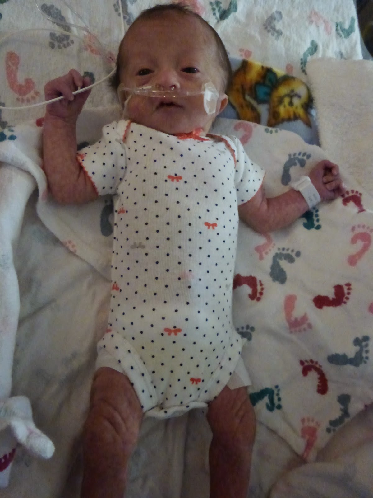 Cherishing Elise: Carrying and Loving Our Trisomy 18 Baby: Elise ...