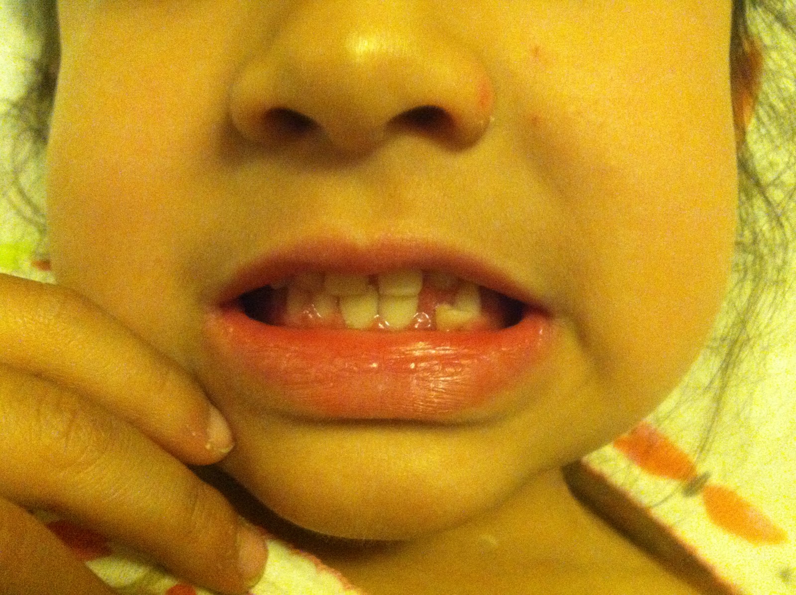 perich brothers (and sister): macey's wiggly tooth