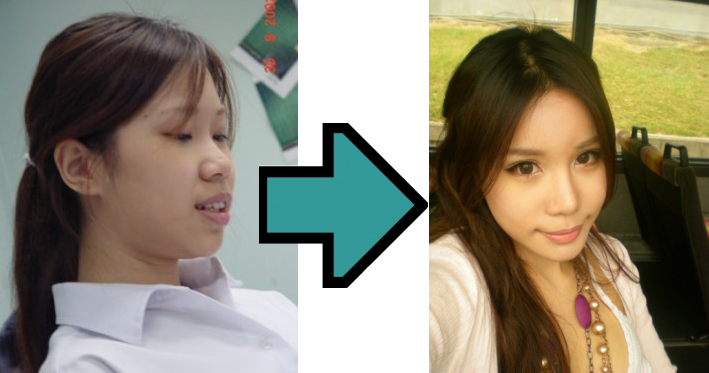 Dawn Yang Before And After