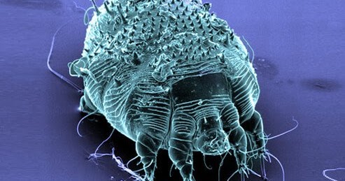 A To Z Medicine Details: What Is Scabies? Rash, Treatment, Symptoms ...