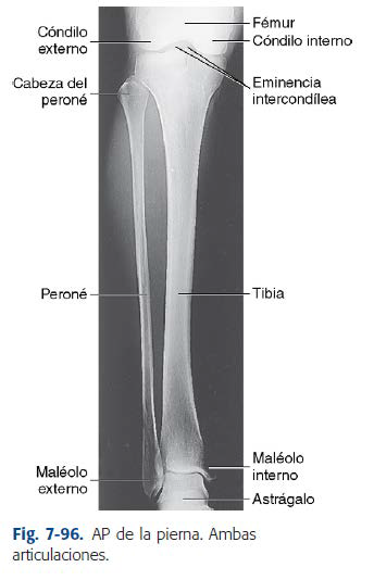 TIBIA Y PERONE