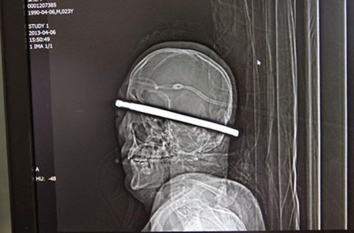 World Of Technology: The Most Ridiculous X-Rays You'll Ever See (22 pics)