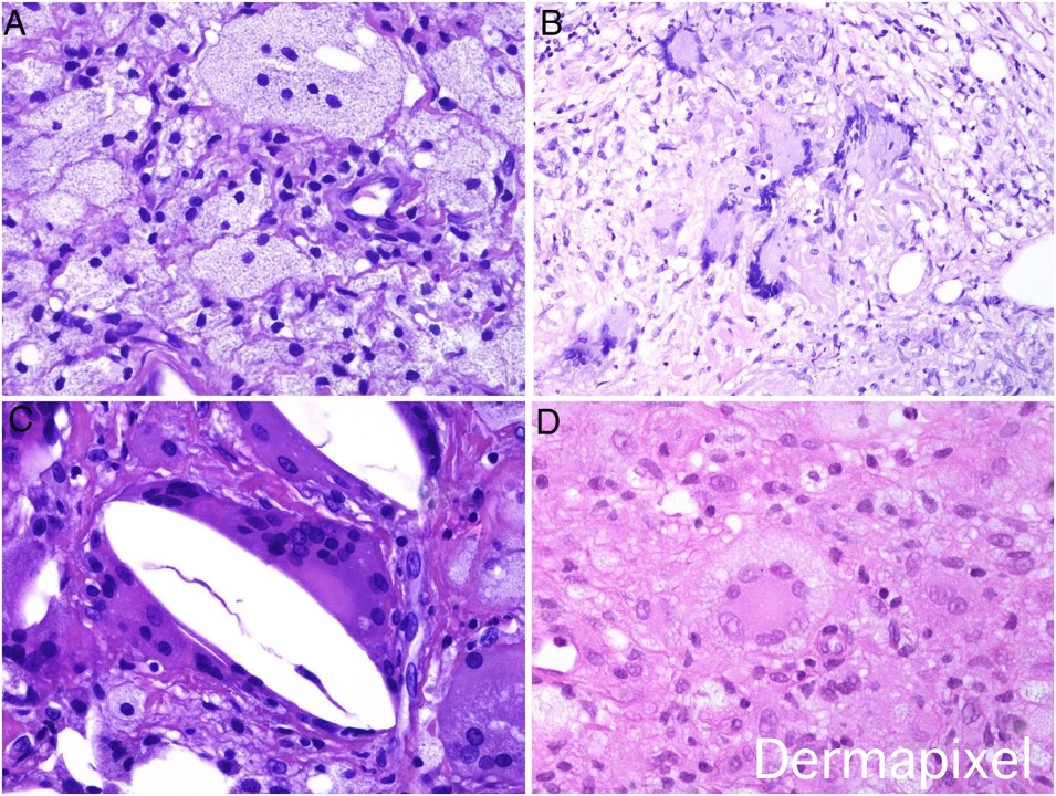 Dermapixel: junio 2021