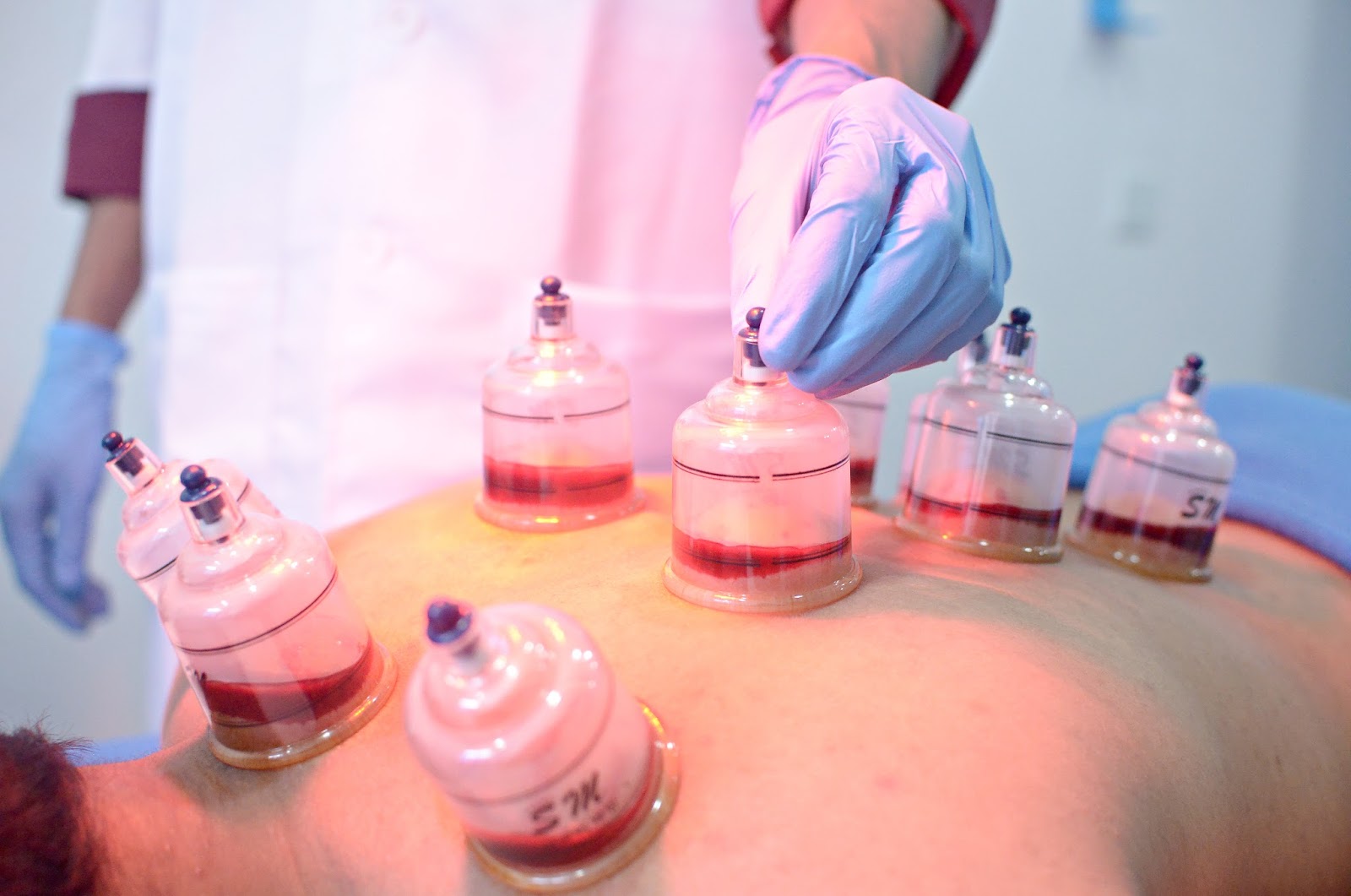 RAWATAN BEKAM DR HIJAMA