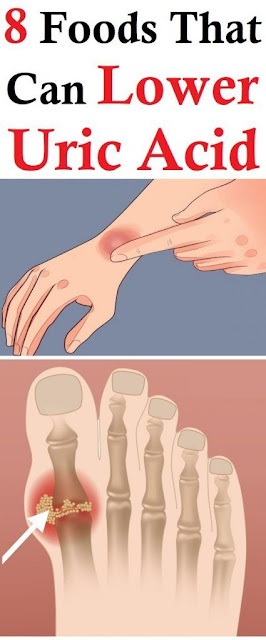 8 Foods Can Lower Uric Acid | Healthy Planning