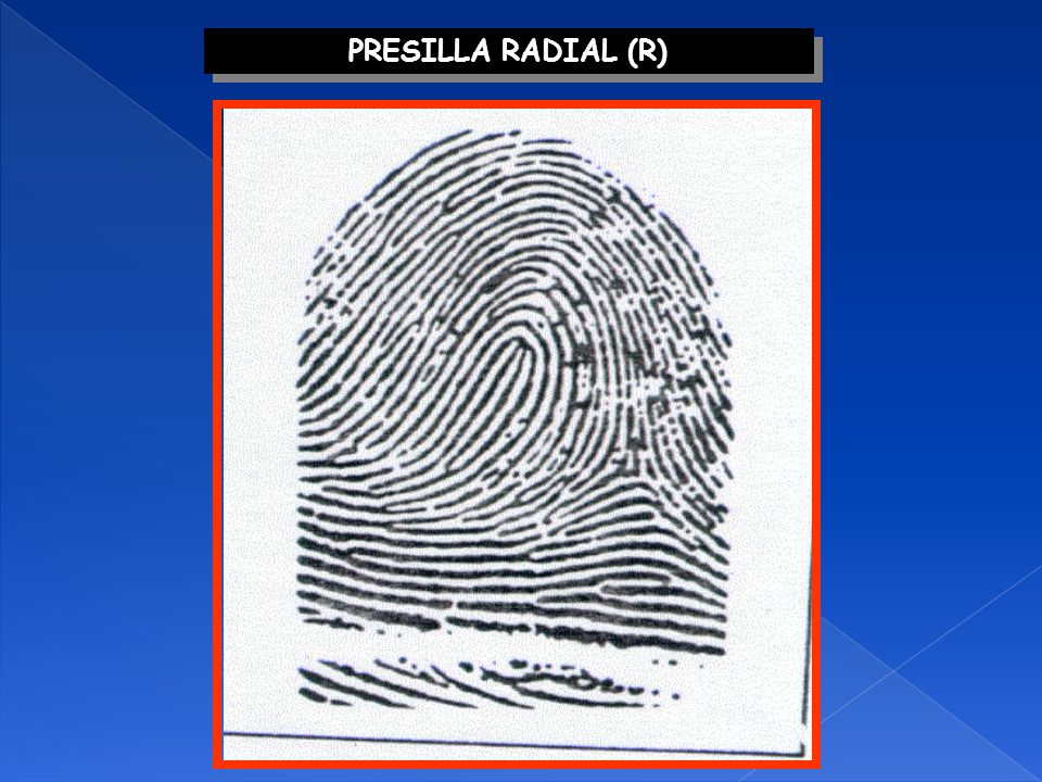 Diferentes Tipos de Dactilogramas