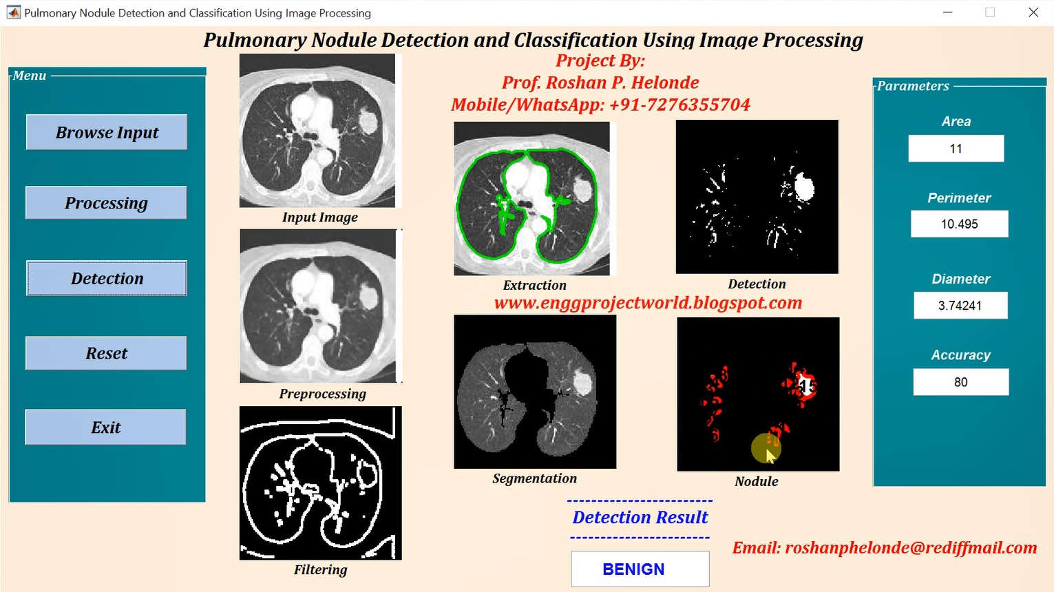 Lung Nodule Detection Using Image Processing Matlab Project With Source Code Ieee Based Projects