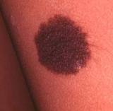 "Marianny Guzman" Semiología Quirurgica: Examen de Cabeza y Cuello I