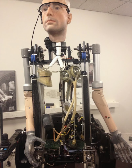 Bionic Man Walks, Breathes With Artificial Parts - Stunning Interesting ...