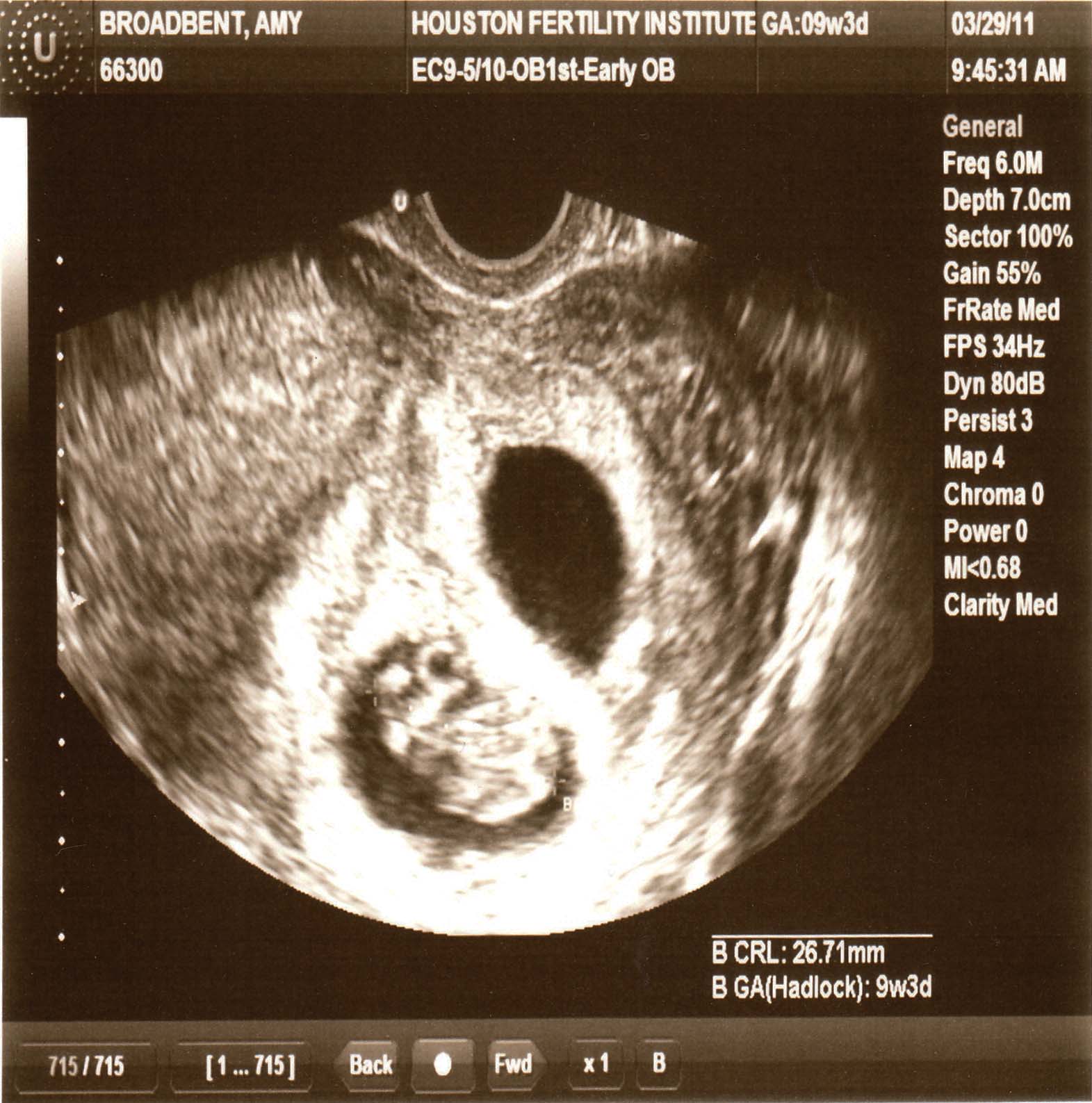 Maternal Hope: 9w5d "All by Myself"