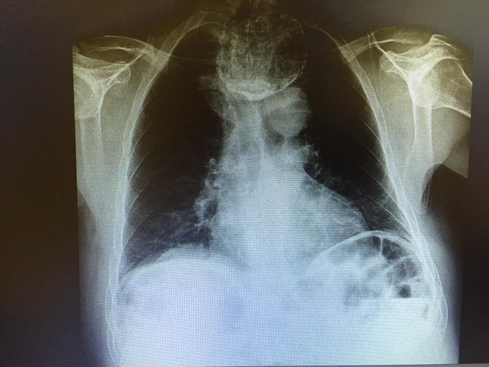 EL RINCÓN DE LA MEDICINA INTERNA. juanpedromacaluso@yahoo.com.ar: 20 ...