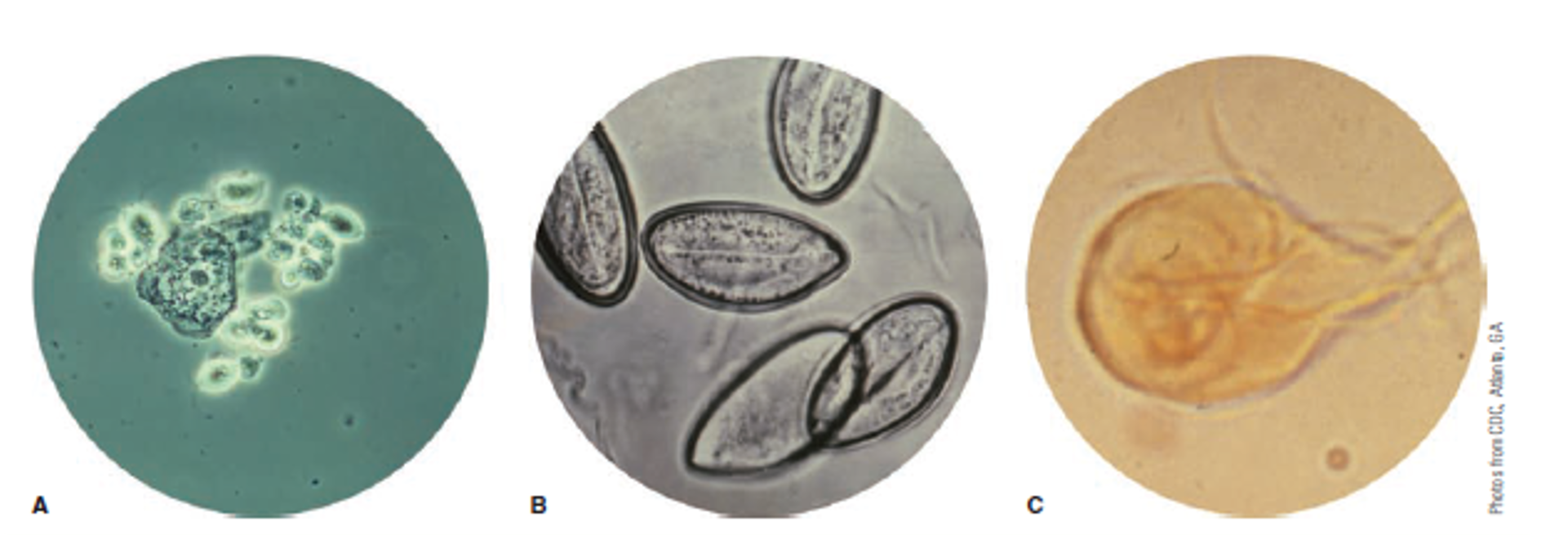 Parasitologi Klinik | Parasit dan Pemeriksaannya