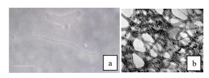 AGRICULTURE LOVER'S : Turnip Mosaic Virus (TuMV)