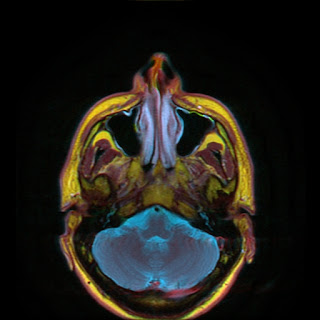 Nevit's blog: Color MRI of the Neck