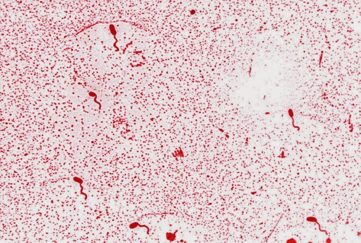 Miscellaneous Gram-Negative Bacteria | Tuyenlab