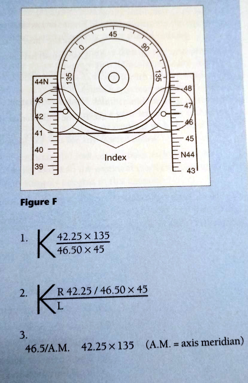 KERATOMETRY OR OPHTHALMOMETRY
