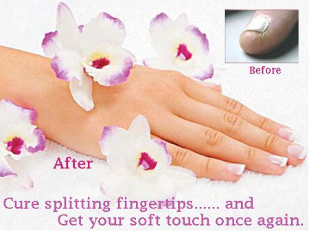 Skin Splitting on fingers: Causes & Treatement