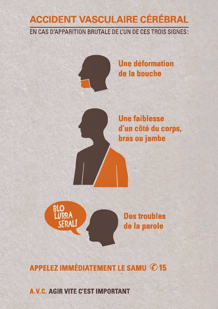 L'accident vasculaire cérébral (AVC) | Récap' IDE