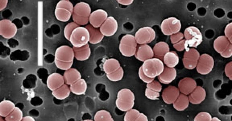 Cervezal: Pediococcus