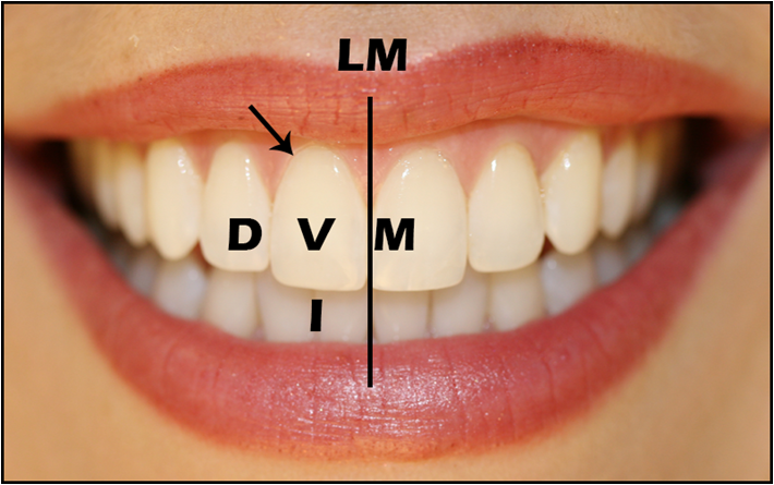 Introdução à Anatomia Dental Parte #1 - Divisão dos Dentes em Faces ...