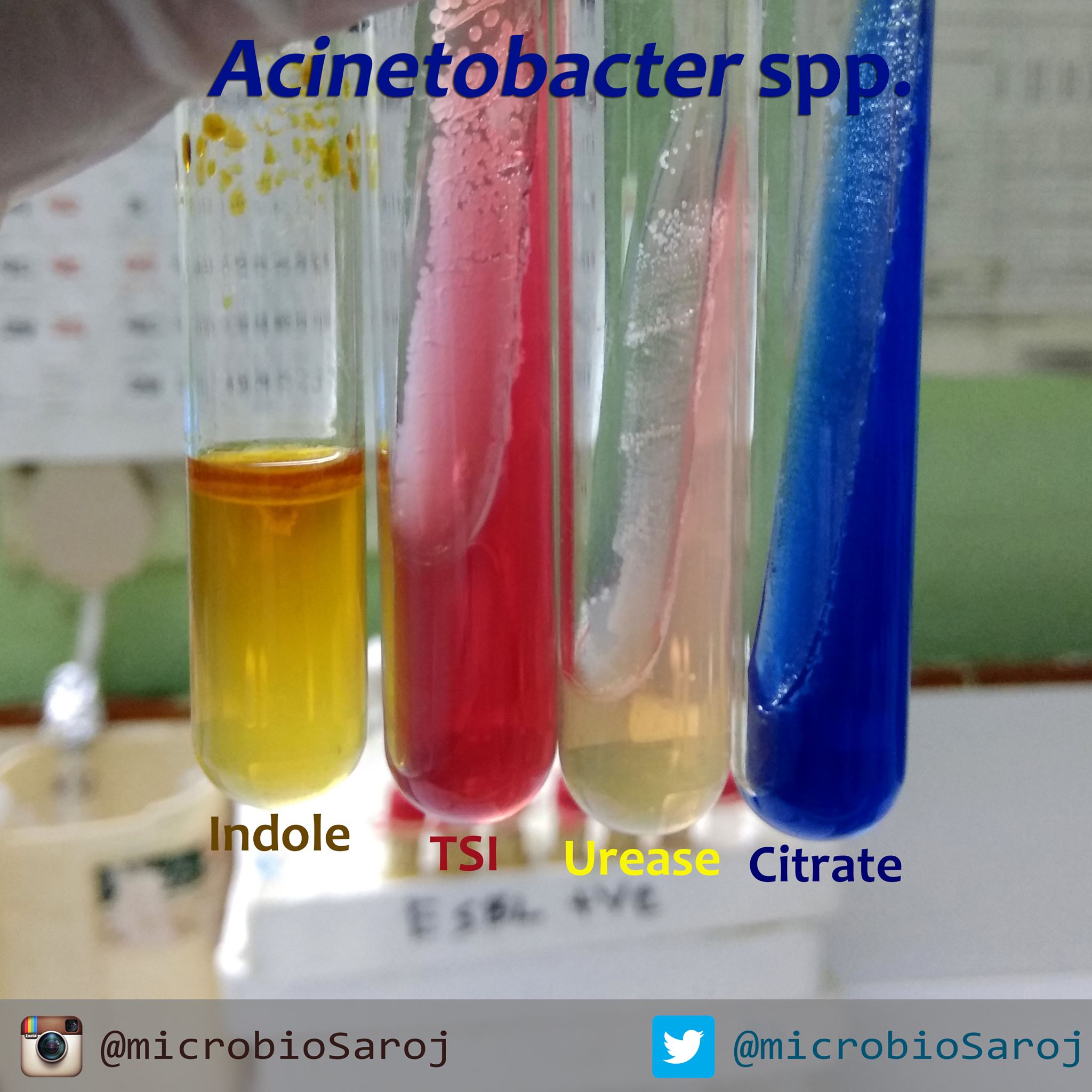 MICROBIOLOGY BLOG FOR STUDENTS (MBLOGSTU): Cultural and Biochemical ...