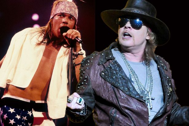 Axl Rose then and now (4)