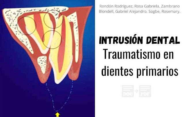 PDF: INTRUSIÓN DENTAL: Traumatismo en dientes primarios - Revisión de ...