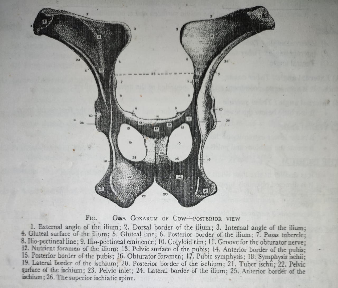 Pelvic Girdle | Gross Anatomy | Anjani Mishra