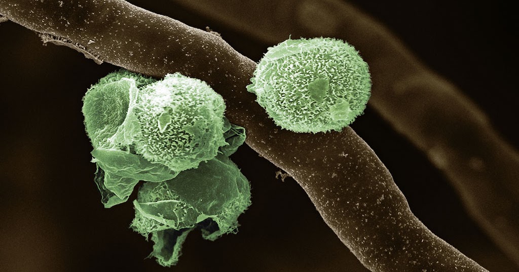XTerraSpace: Algae living inside fungi: How land plants first evolved