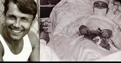 Appendix| A doctor had to remove his own appendix| Curio Facts