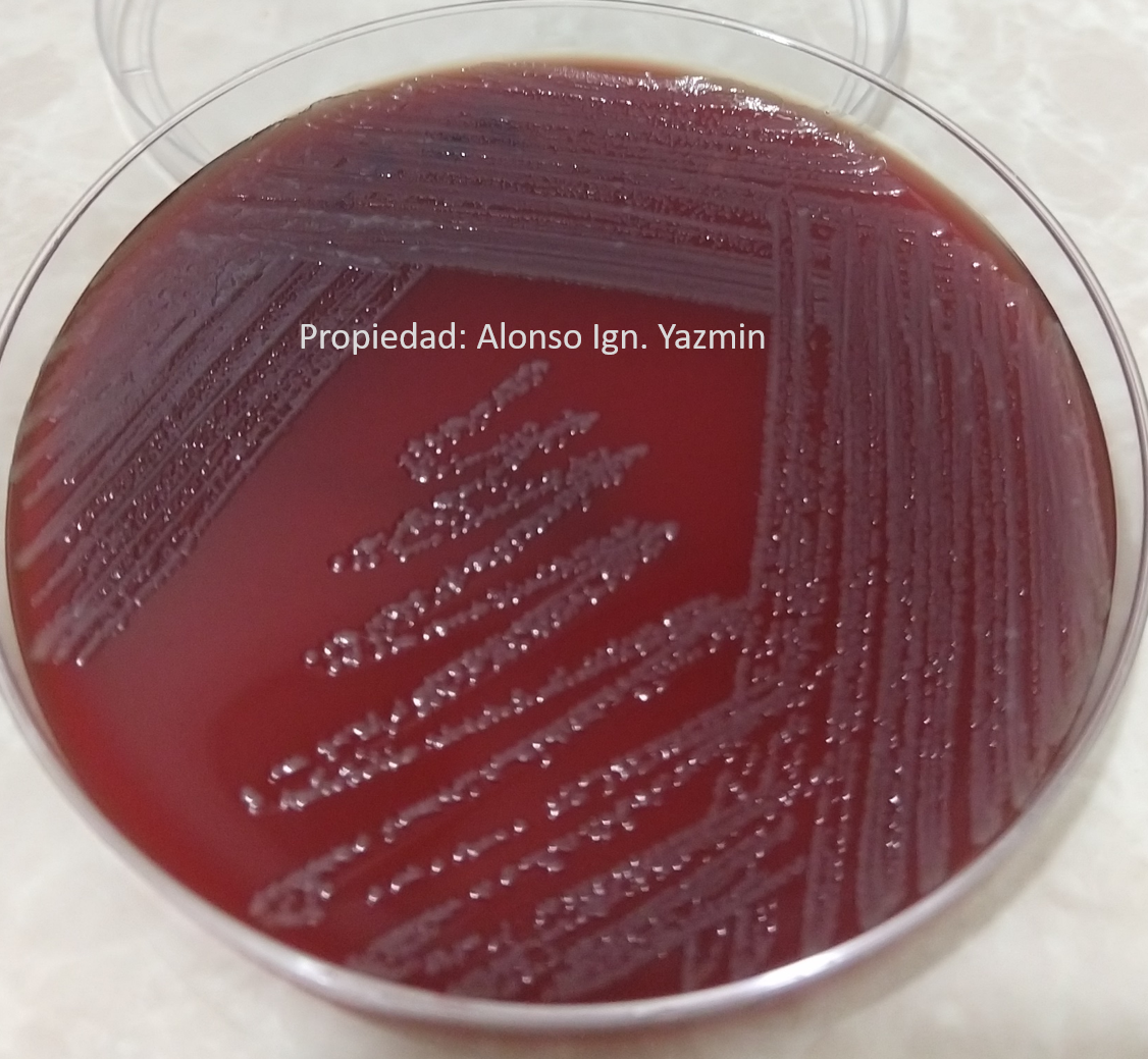 Bioquímica Diagnóstica BQD-YAI: Enterobacter cloacae
