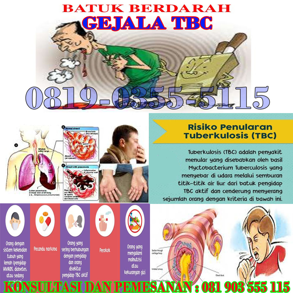Nama Obat TBC Paling Ampuh Paling Aman