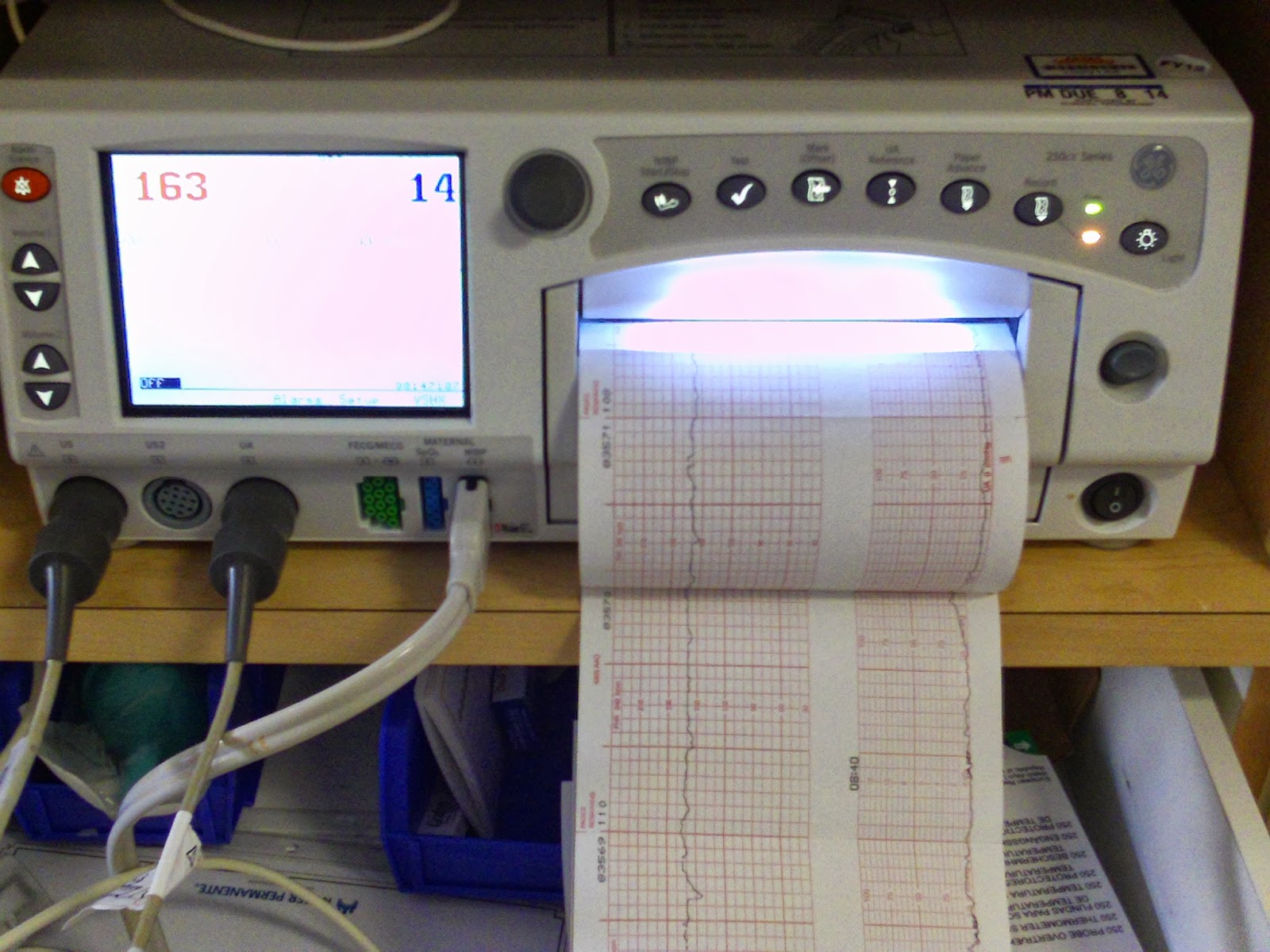 Roscoe's Story: Monitoring the Baby