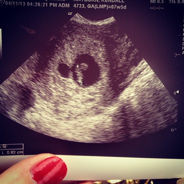 8 weeks baby update + first photo!! - Kendall Rayburn