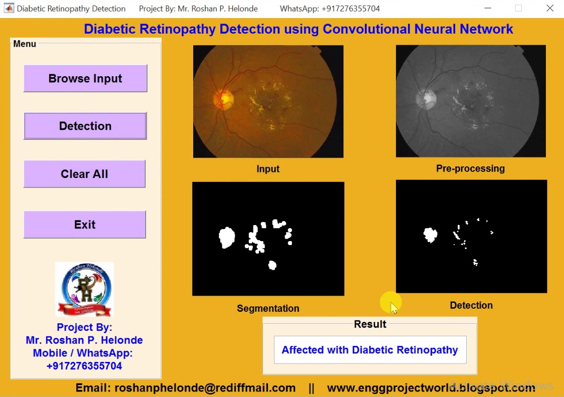 Diabetic Retinopathy Detection using Convolutional Neural Network full ...