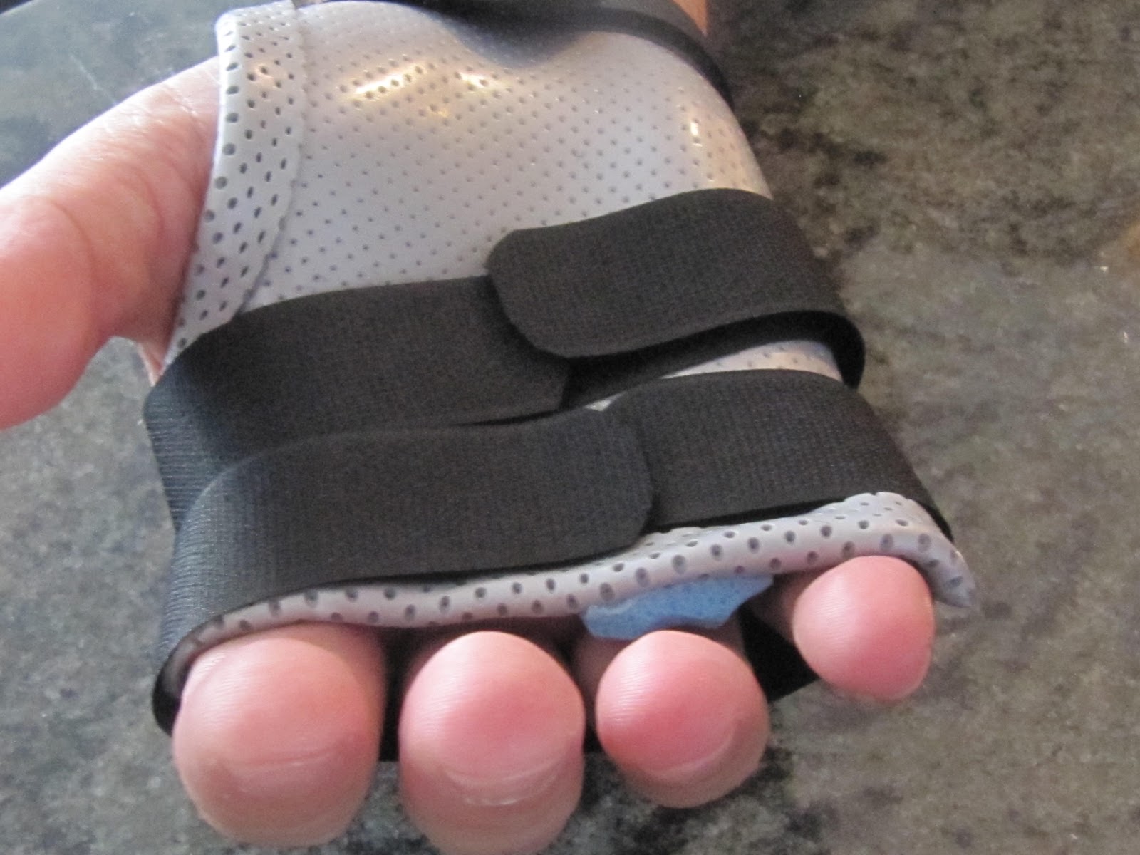 Orthèses Main-Poignet Lyon : photos