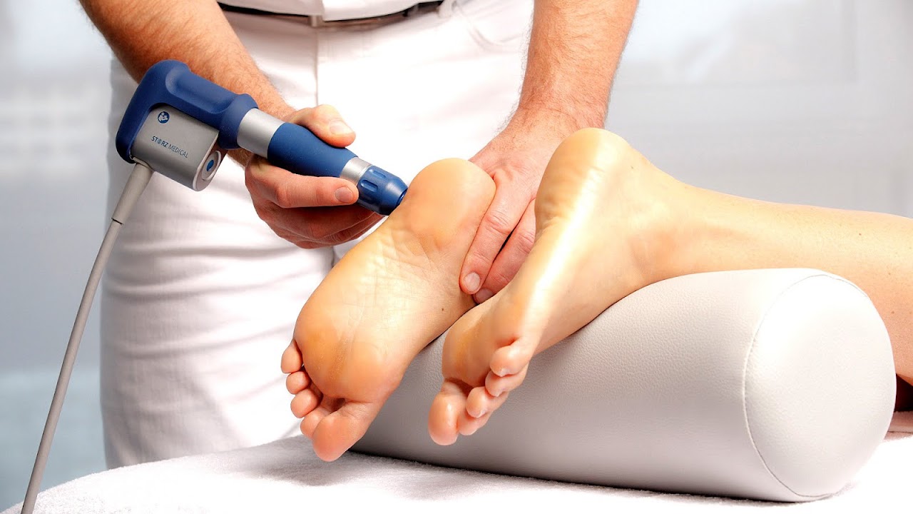 Shockwave Therapy For Plantar Fasciitis Science Science Choices shockwave-therapy-for-plantar-fasciitis-science-science-choices