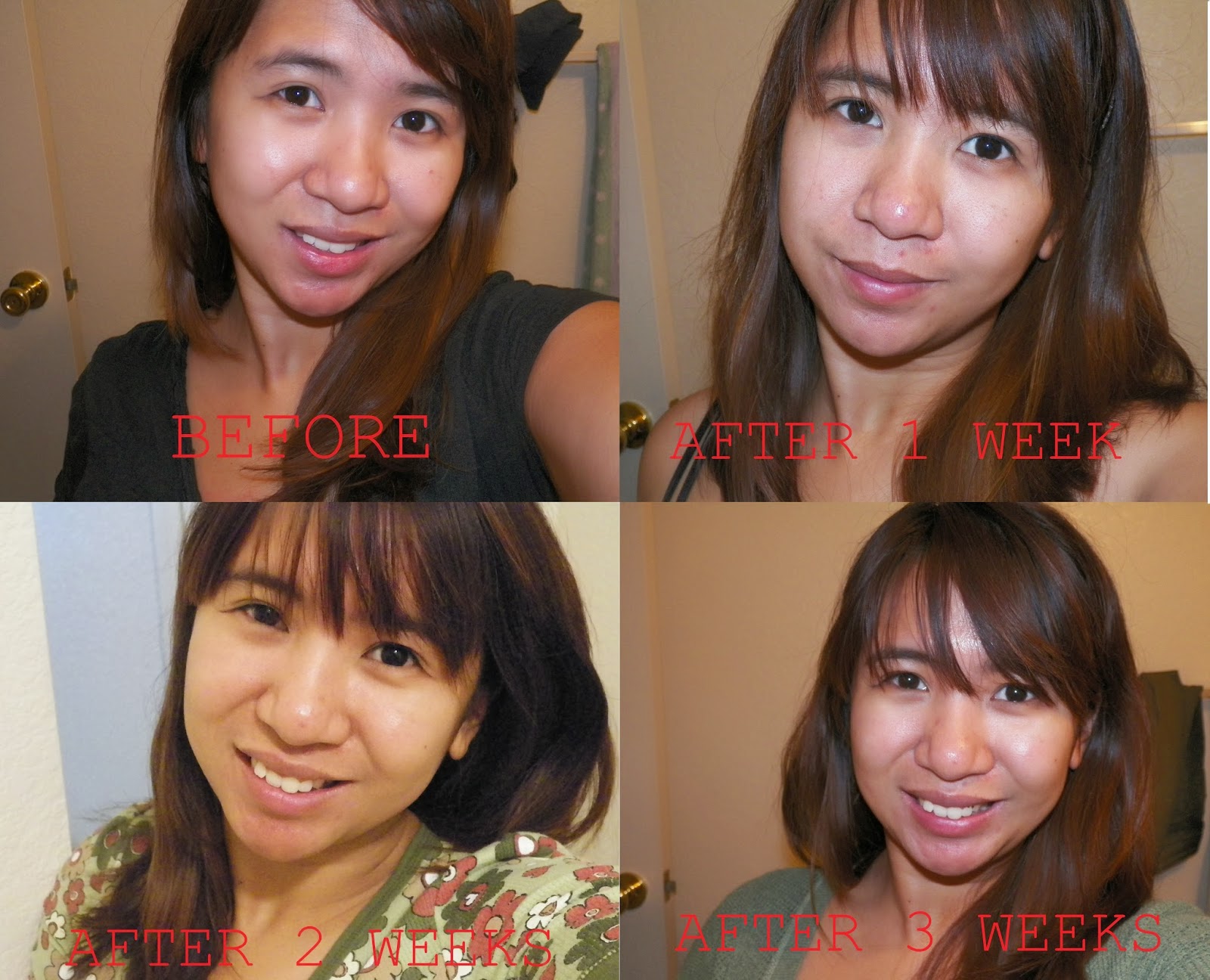 mygreatfinds: La Beaute Pure Vitamin C Serum Update Week 2 and 3